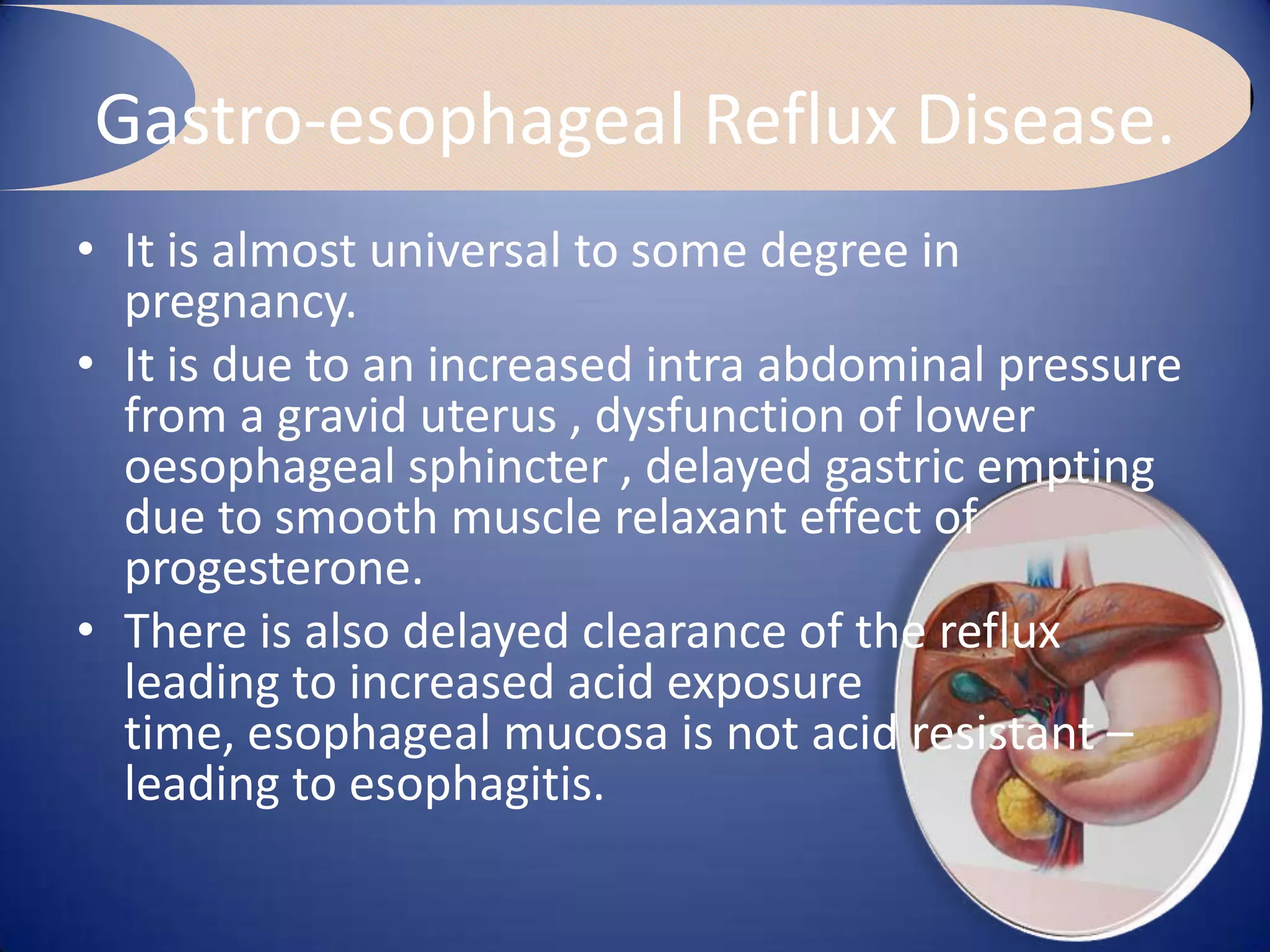 Epigastric pain in pregnancy | PPTX