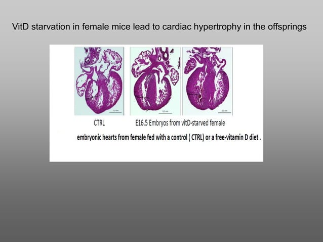 Epigenetic regulation of cardiogenesis | PPT