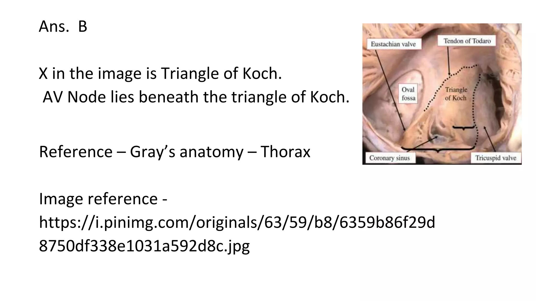 EPIGNOSIS-CARDIOLOGY QUIZ-PRELIMS.pptx | Heart and Cardiovascular ...
