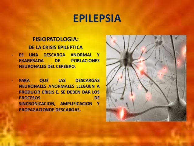 Epilepsia