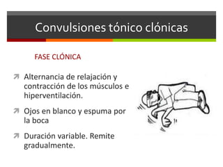 epilepsia historia definicion epidemiologia fisiopatologia diagnostico ...