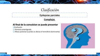 Epilepsia | PPTX
