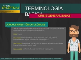 epilepsia, crisis epilépticas, convulsiones tónico clónicas 2024 2024 ...