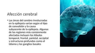 Epilepsia y Convulsiones Adulto Mayor.pptx