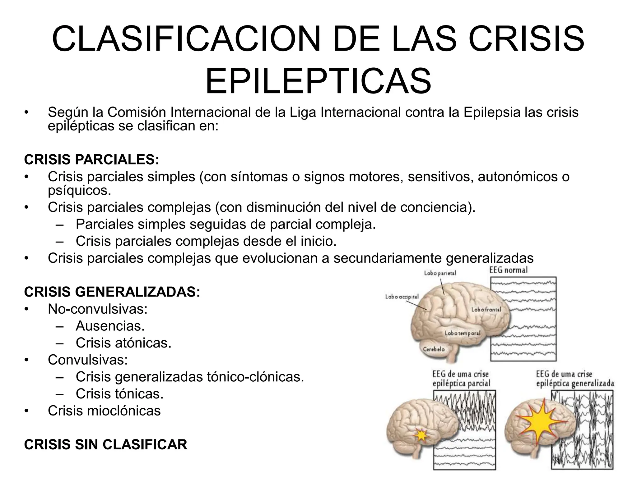 Epilepsia - Actualización para estudiantes de pregrado | PPT