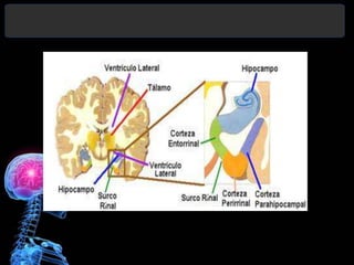 Epilepsia del lobulo temporal mesial | PPTX