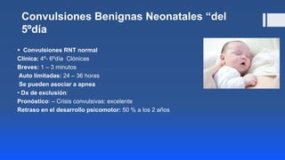 Convulsiones Neonatales | PPTX