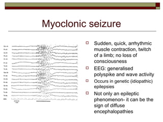 Epilepsy | PPT