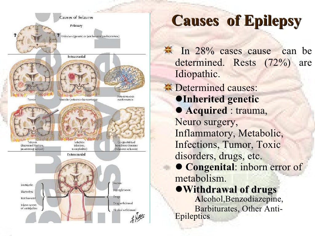 Epilepsy An Overview