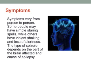 Epilepsy | PPT