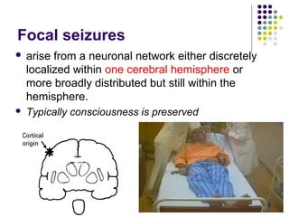 Epilepsy | PPT