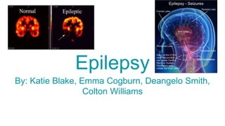 Epilepsy | PPTX