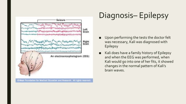 Epilepsy Case Study | PPTX | Brain and Nervous System Disorders | Diseases and Conditions