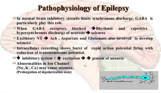 Epilepsy