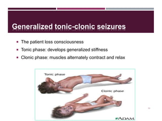 Epilepsy | PPTX | Brain and Nervous System Disorders | Diseases and ...