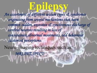 Pharmacology of Anti-Epileptics | PPTX