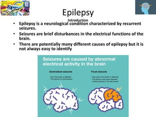 Epilepsy | PPT