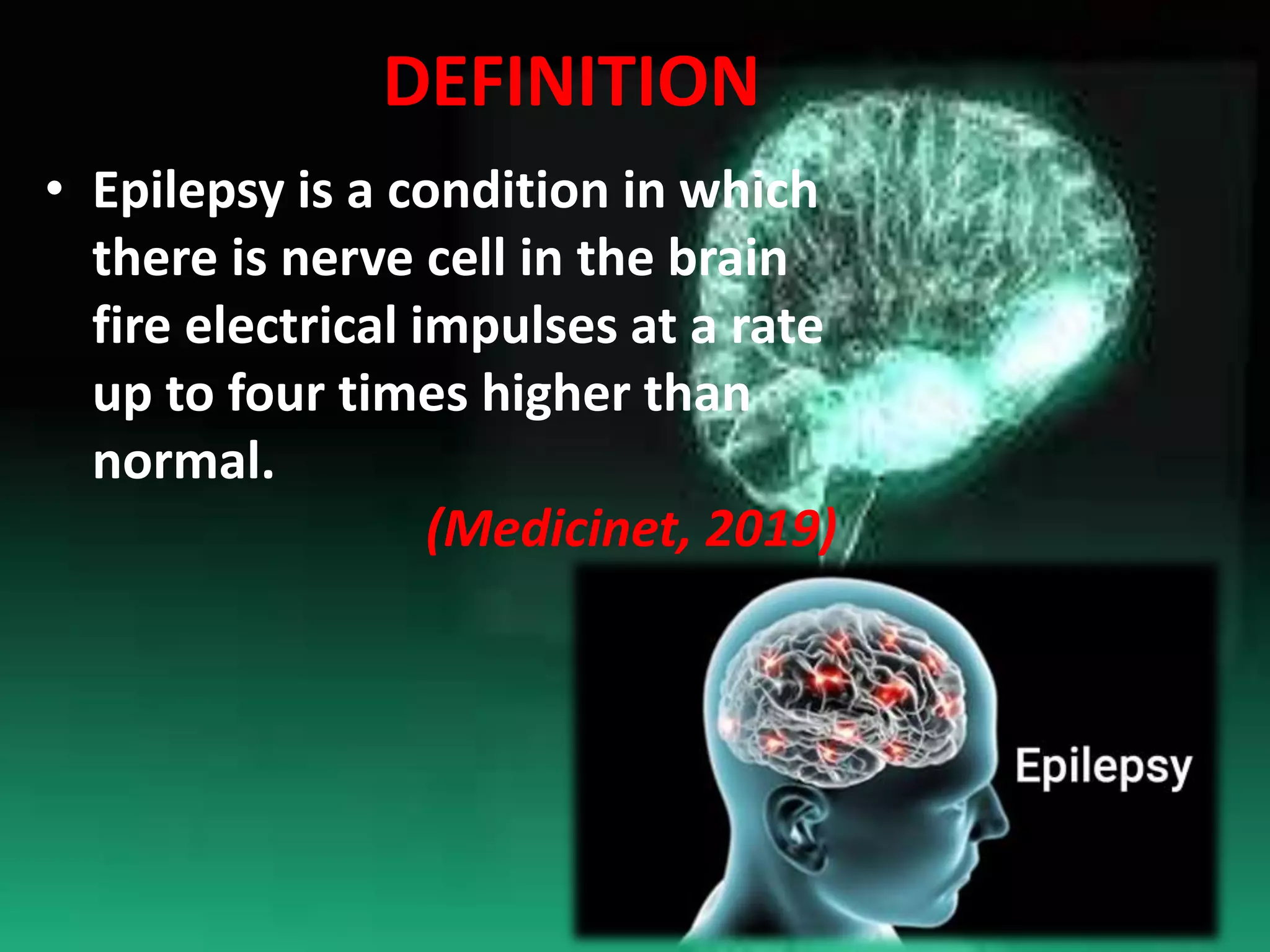 Epilepsy | PPTX