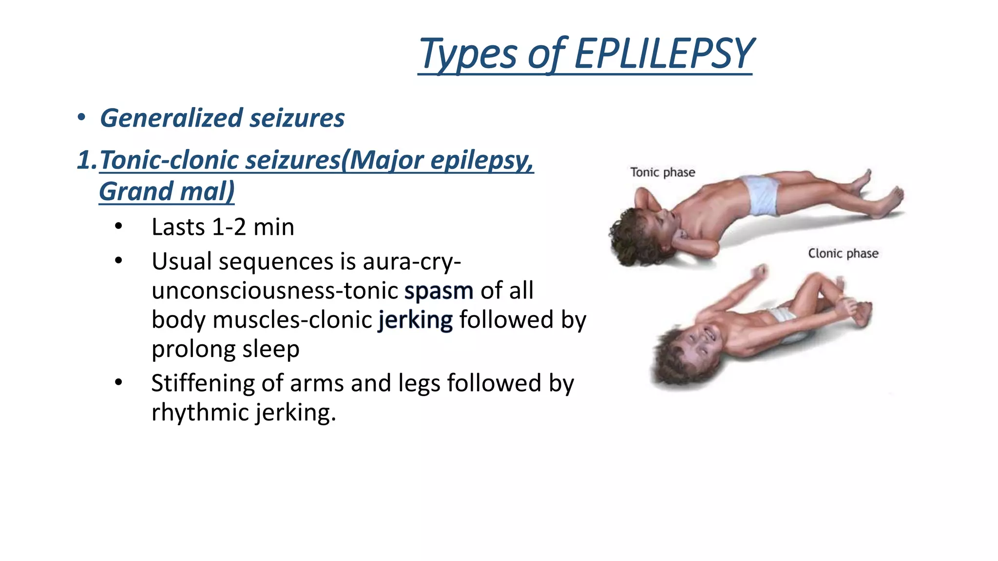 epilepsy-210211104538.pdf