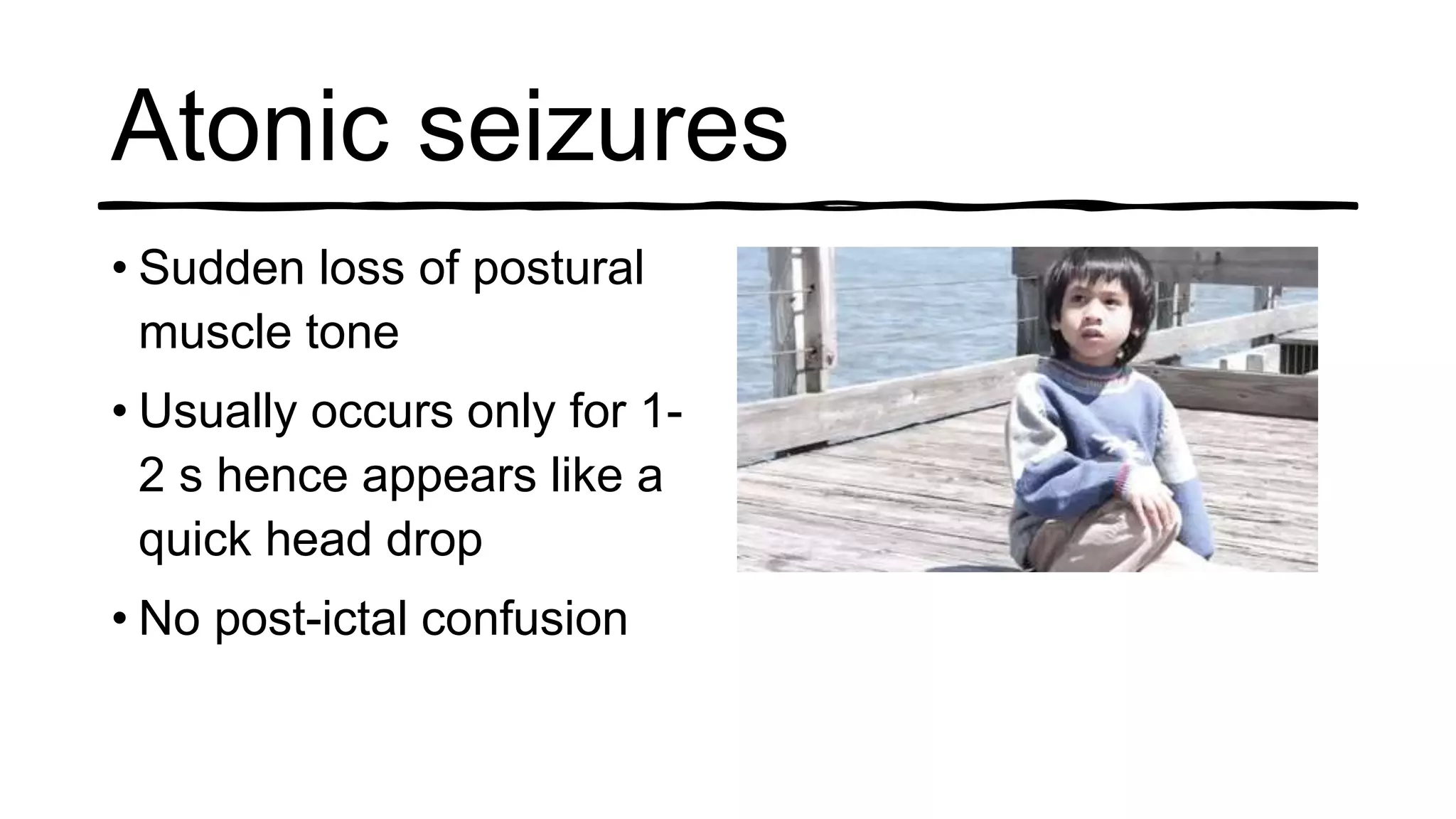 Clinical features of epilepsy | PPTX