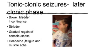 Clinical features of epilepsy | PPTX