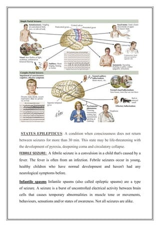 EPILEPSY.pdf