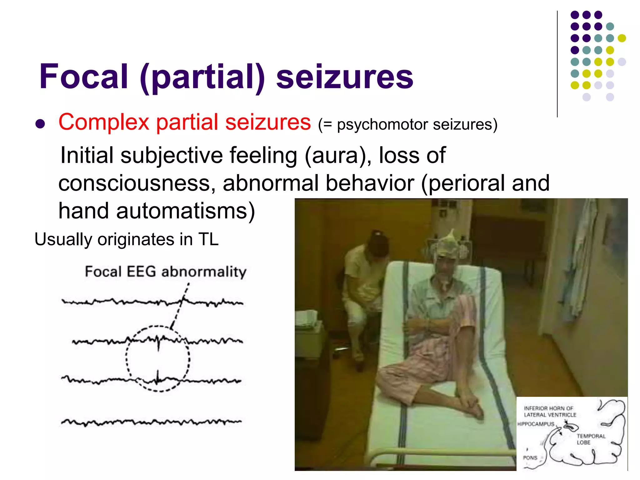 epilepsy.ppt