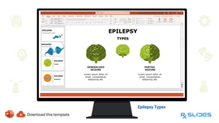 Epilepsy | PPT