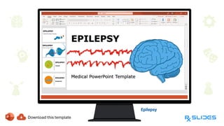 Epilepsy | PDF
