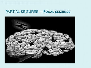 pediatrics. epilepsy and seizures in children 8.ppt