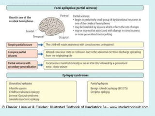 pediatrics. epilepsy and seizures in children 8.ppt