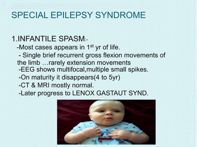 pediatrics. epilepsy and seizures in children 8.ppt | Brain and Nervous ...