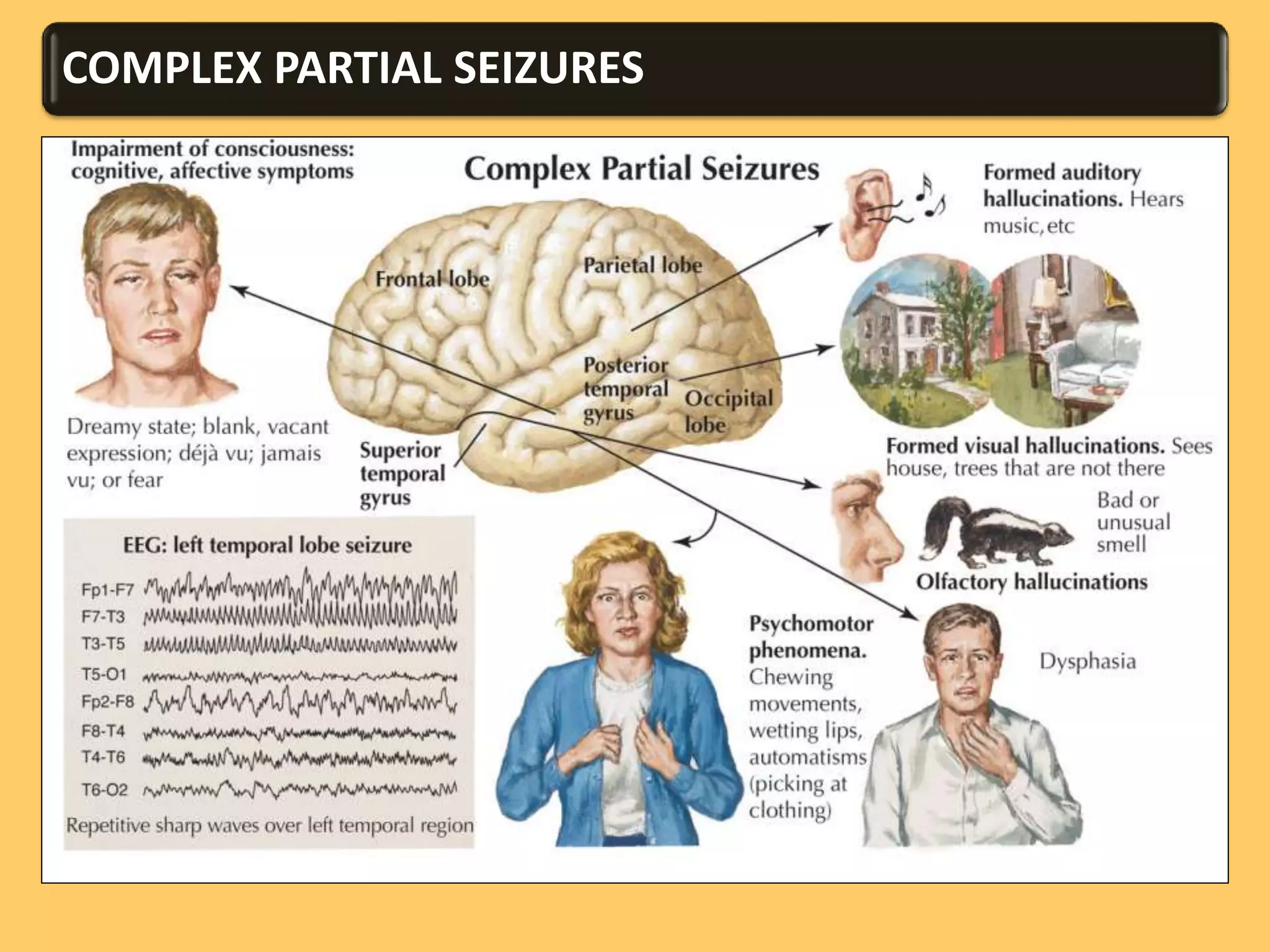 Epilepsy and its management (ppt) | PPTX