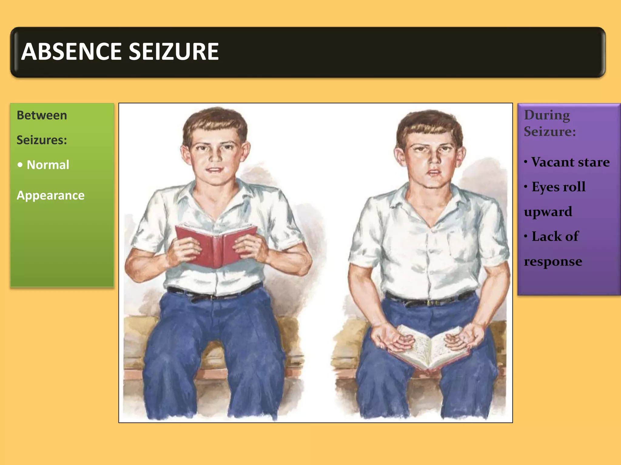 Epilepsy and its management (ppt) | PPTX