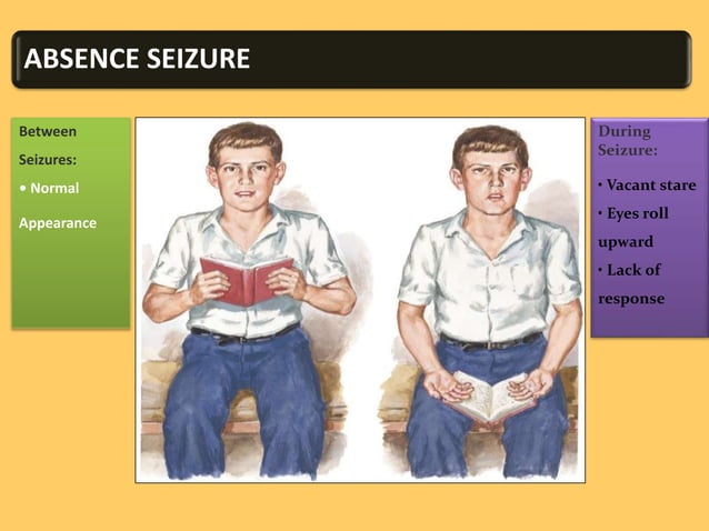 Epilepsy and its management (ppt) | PPTX