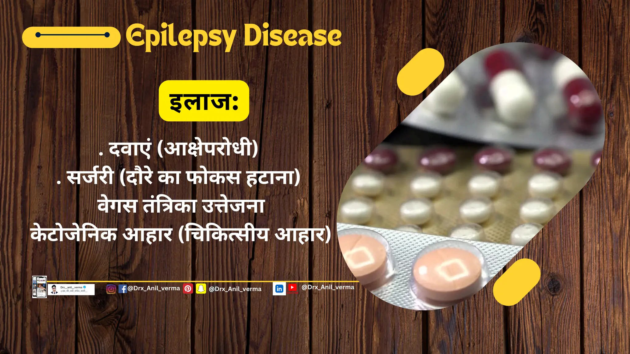 Epilepsy Disease in hindi Drx anil verma.pdf