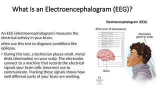 EPILEPSY & EEG types and management its uses | PPTX