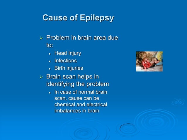 Epilepsy General information in English | PPT