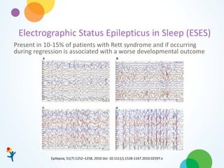 Epilepsy in rett and rrd Dr. Scott Demarest | PPT