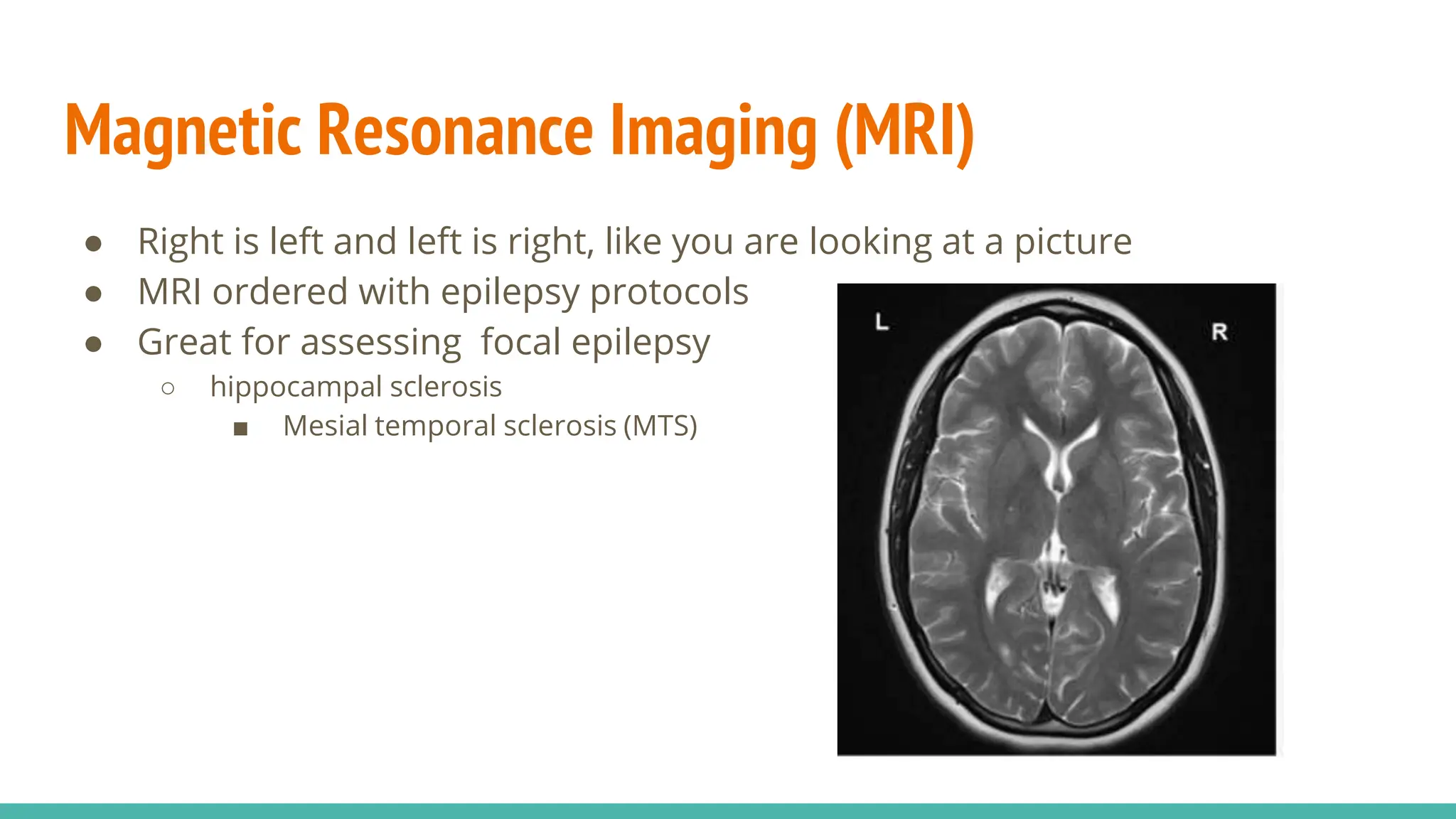 Epilepsy Monitoring Unit (EMU) protocols.pptx
