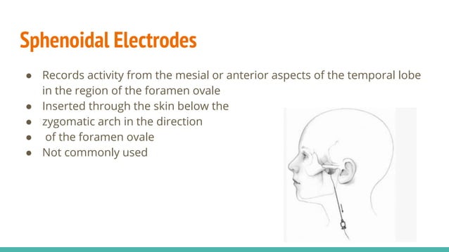 Epilepsy Monitoring Unit (EMU) protocols.pptx