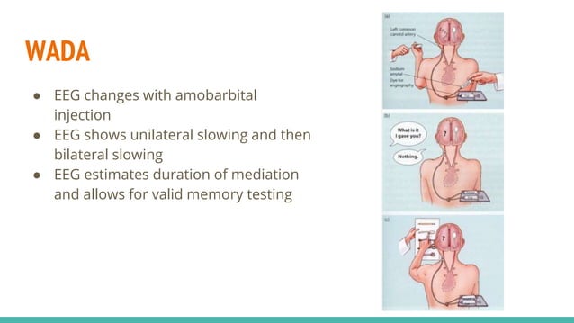 Epilepsy Monitoring Unit (EMU) protocols.pptx