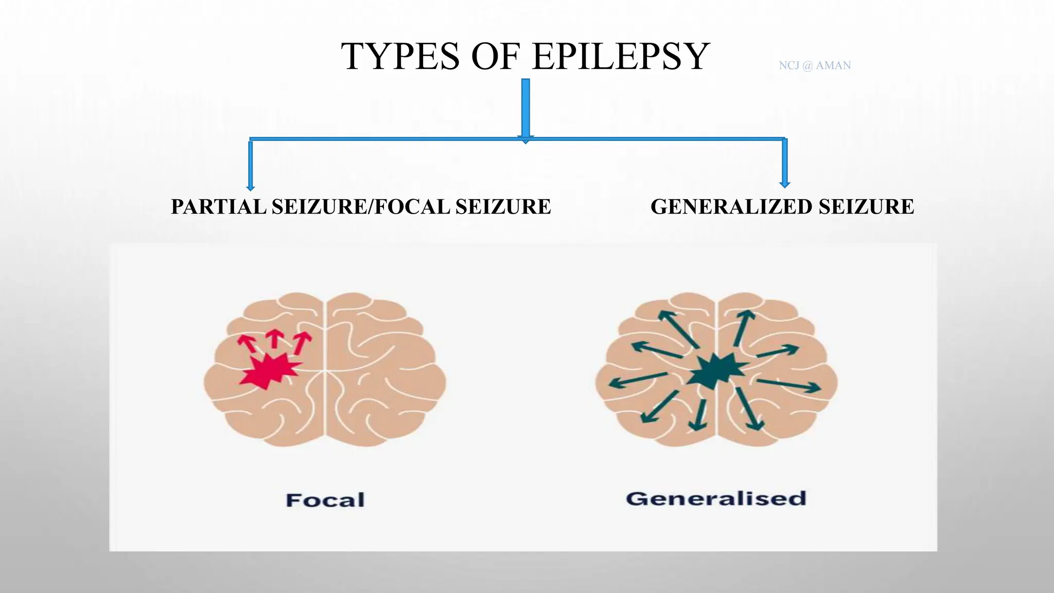 Epilepsy [Seizure disorders].pptx