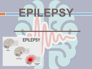 EPILEPSY For Medical Students And Health care | PPTX
