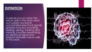 *Title: of Epilepsy: Symptoms, Diagnosis, and Treatment* | PDF