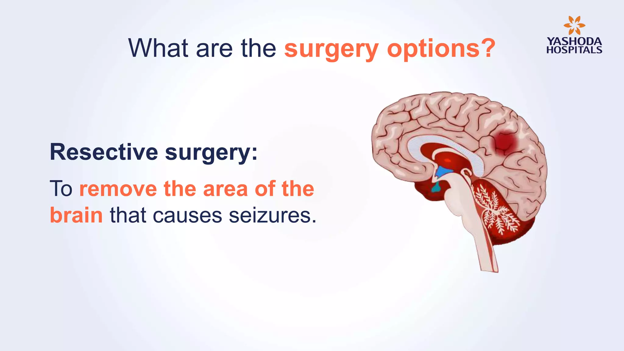 Epilepsy or Seizures: Symptoms, Causes, Prevention and Treatment | PPTX