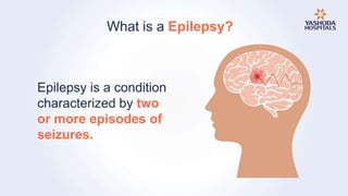 Epilepsy or Seizures: Symptoms, Causes, Prevention and Treatment | PPTX