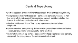 Epilepsy surgery | PPTX
