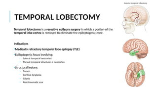 Epilepsy Surgery Neurosurgery Teory.pptx