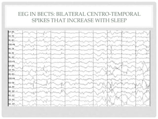 Epilepsy syndromes | PPTX